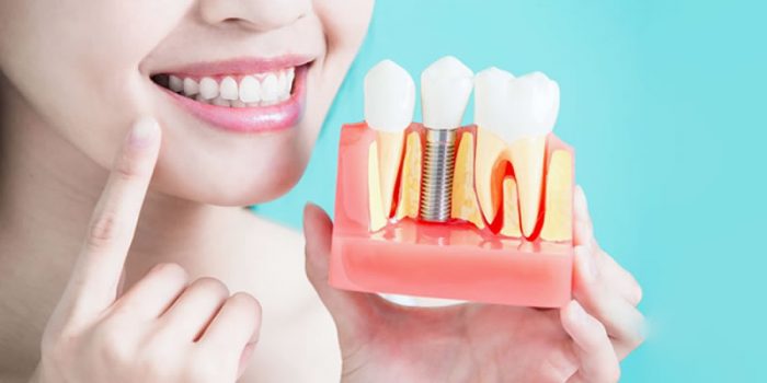 How is Implant Clinical Examination Performed? | Emident Dental Clinic